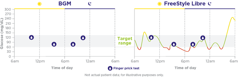 Difference between FreeStyle Libre (CGM) and BGM | Learn | Abbott