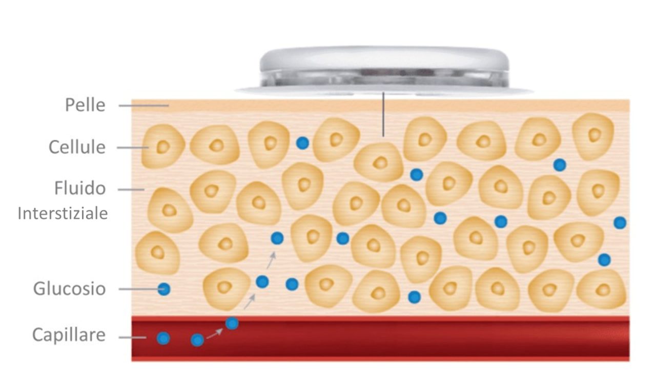 Sistema Freestyle Libre 2